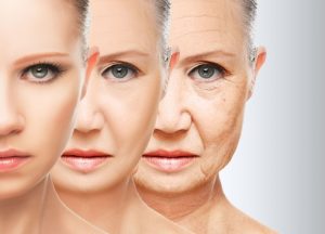 What is Glycation? - Oo La La Cosmetic & Laser Clinic