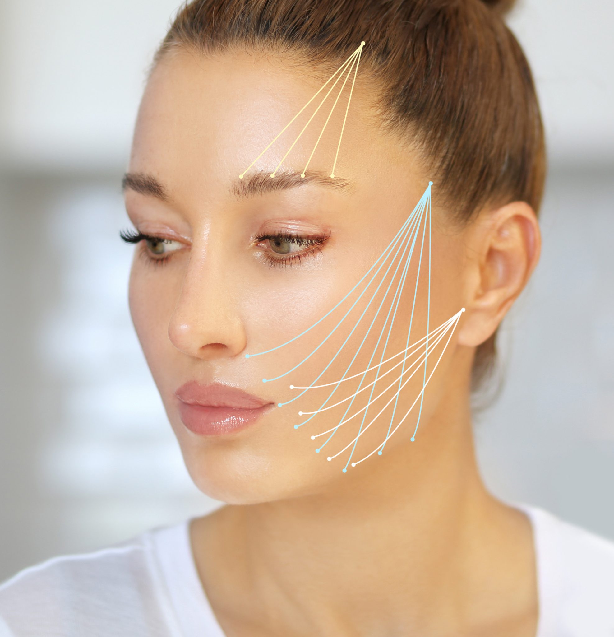 Why are Thread Lifts so popular? - Oo La La Cosmetic & Laser Clinic